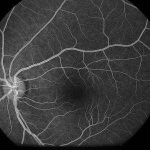 OPTOMED – Fundus Camera Portatile SMARTSCOPE PRO – Opto Medica