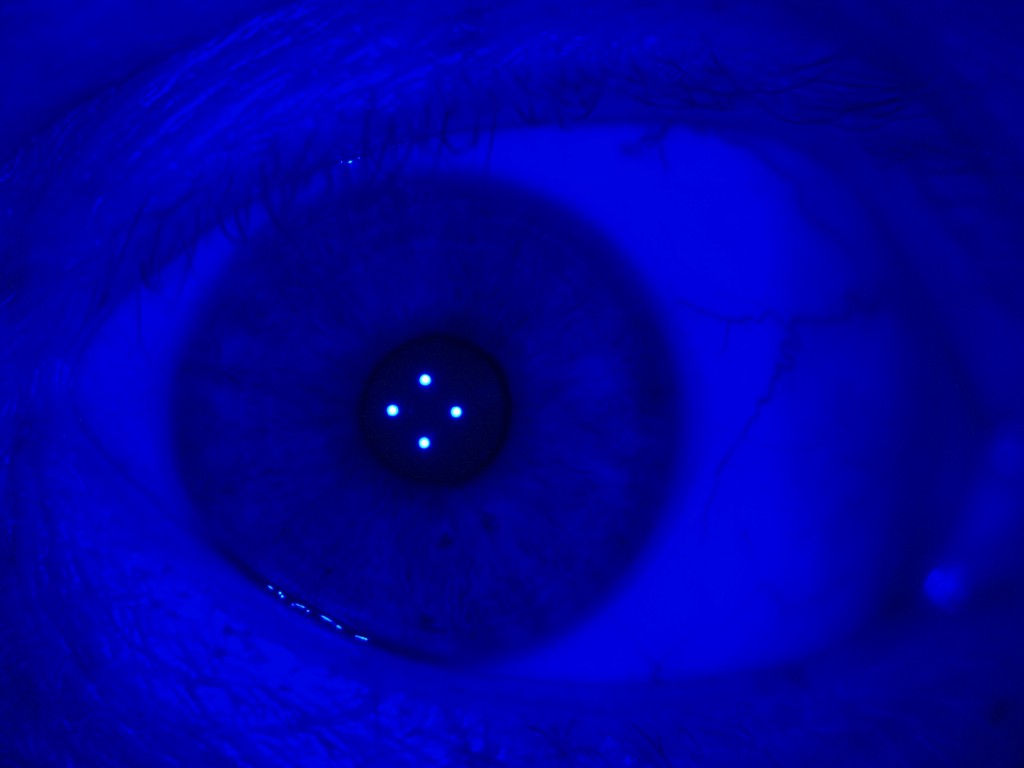 OPTOMED – Fundus Camera Portatile SMARTSCOPE PRO – Opto Medica