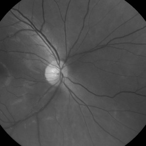 OPTOMED – Fundus Camera Portatile SMARTSCOPE PRO – Opto Medica