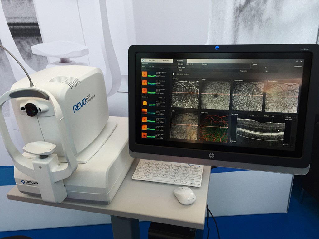 OPTOPOL – Copernicus REVO 60.000/80.000 Scan/Sec – Opto Medica