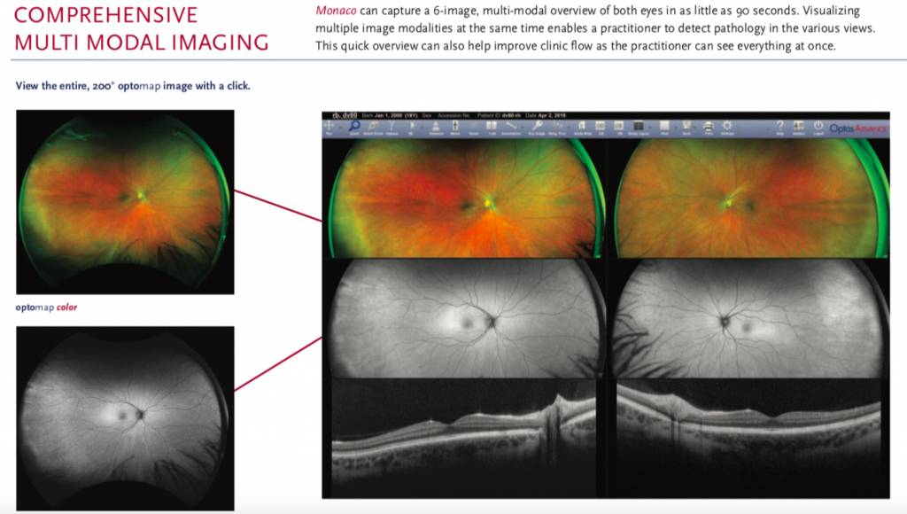 OPTOS – MONACO – Opto Medica